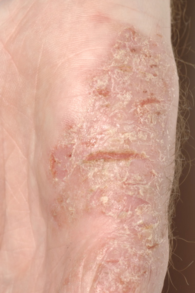 Chowdhury: Dermatology at a Glance