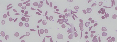 Mehta: Haematology at a Glance