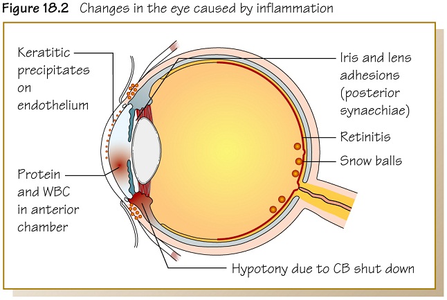 Olver: Ophthalmology at a Glance
