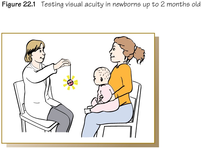 Olver: Ophthalmology at a Glance