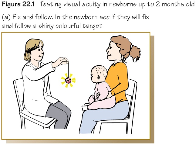 Olver: Ophthalmology at a Glance