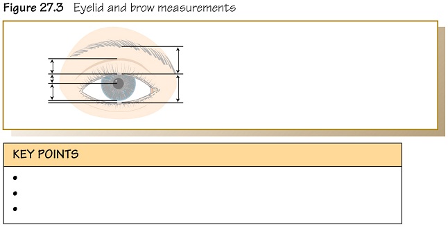 Olver: Ophthalmology at a Glance