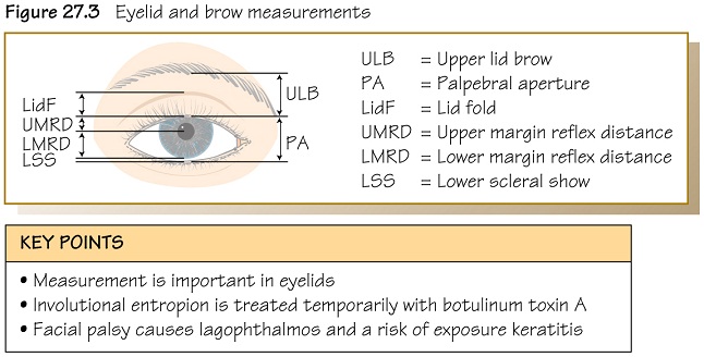Olver: Ophthalmology at a Glance