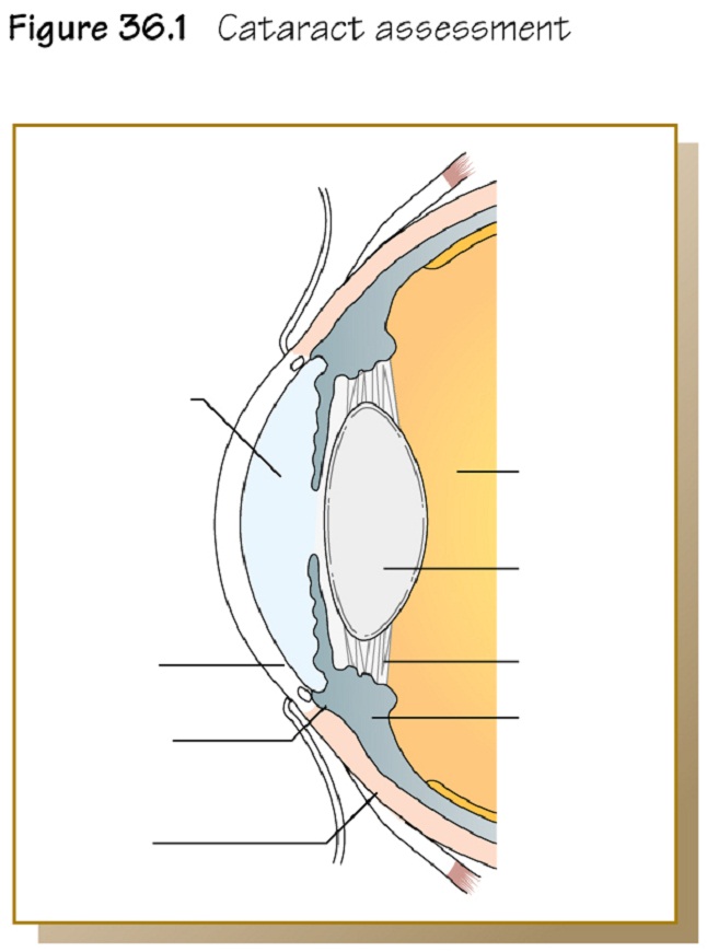 Olver: Ophthalmology at a Glance