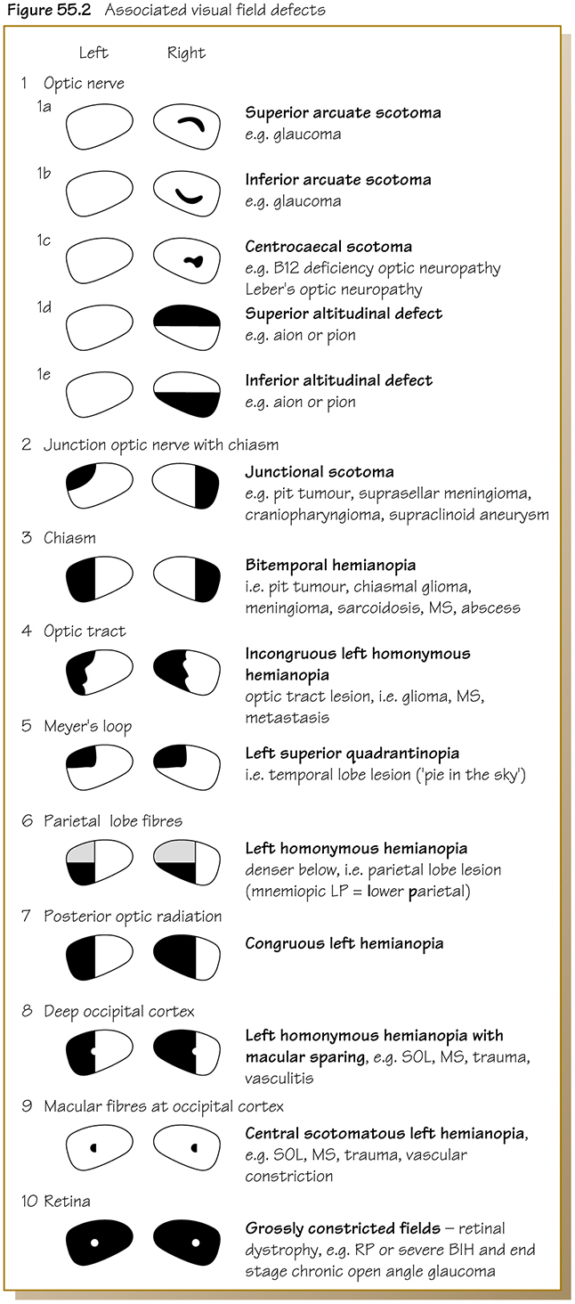 Olver: Ophthalmology at a Glance
