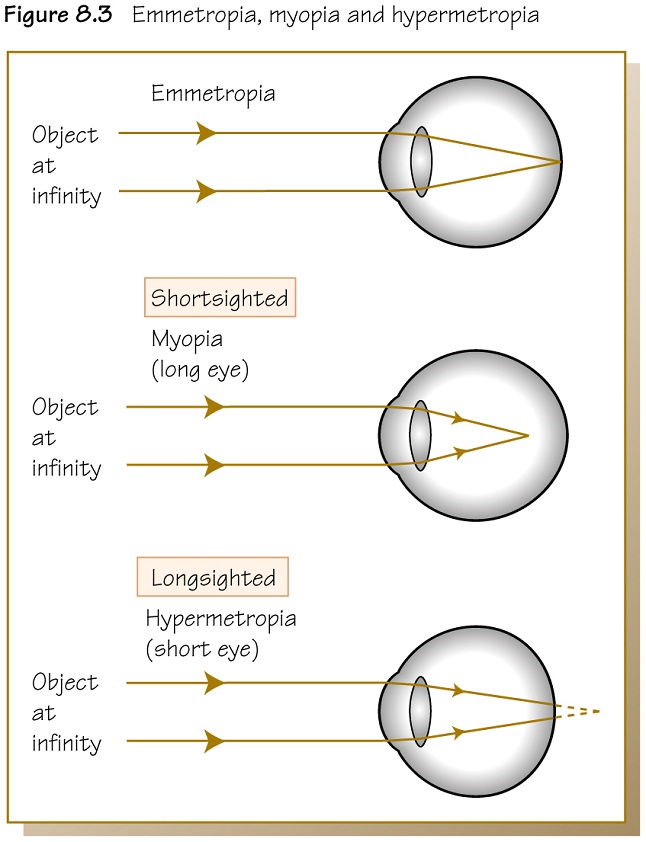 Olver: Ophthalmology at a Glance