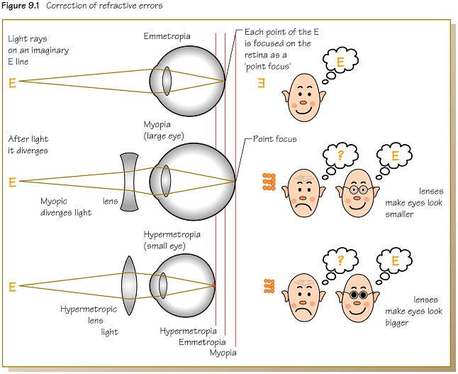Olver: Ophthalmology at a Glance